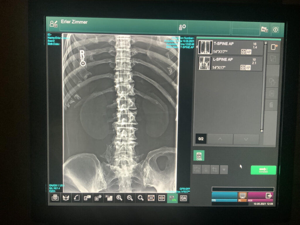 New Radiology Phantom Enhances Student Learning | Logan University